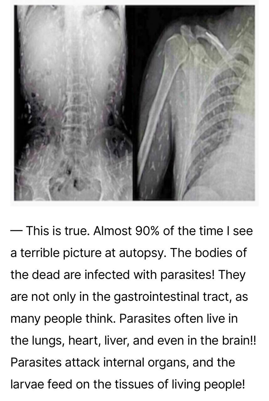Parasites-GEMA Special Report - GEM University